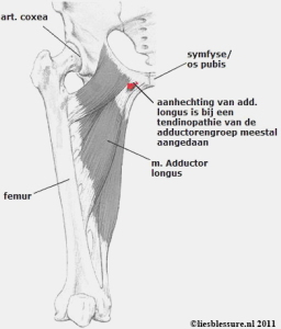 Info liesblessure - PEESBLESSURES
